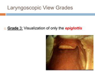 Assessment and management of Airway for BSc Nuursing Students | PPTX