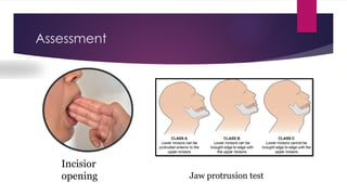 Airway Assessment - in Emergency using History and examination | PPTX