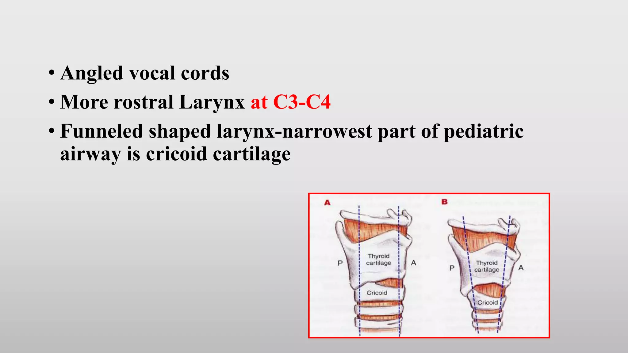 Airway assessment between adult & paediatrics | PPTX