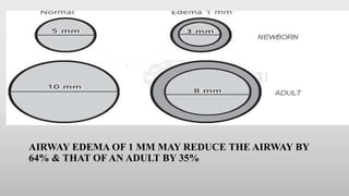 Airway assessment between adult & paediatrics | PPTX