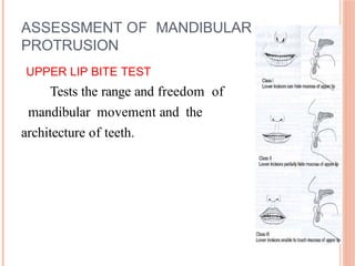 AIRWAY ASSESSMENT AND AIRWAY MANAGEMENT-1.pptx