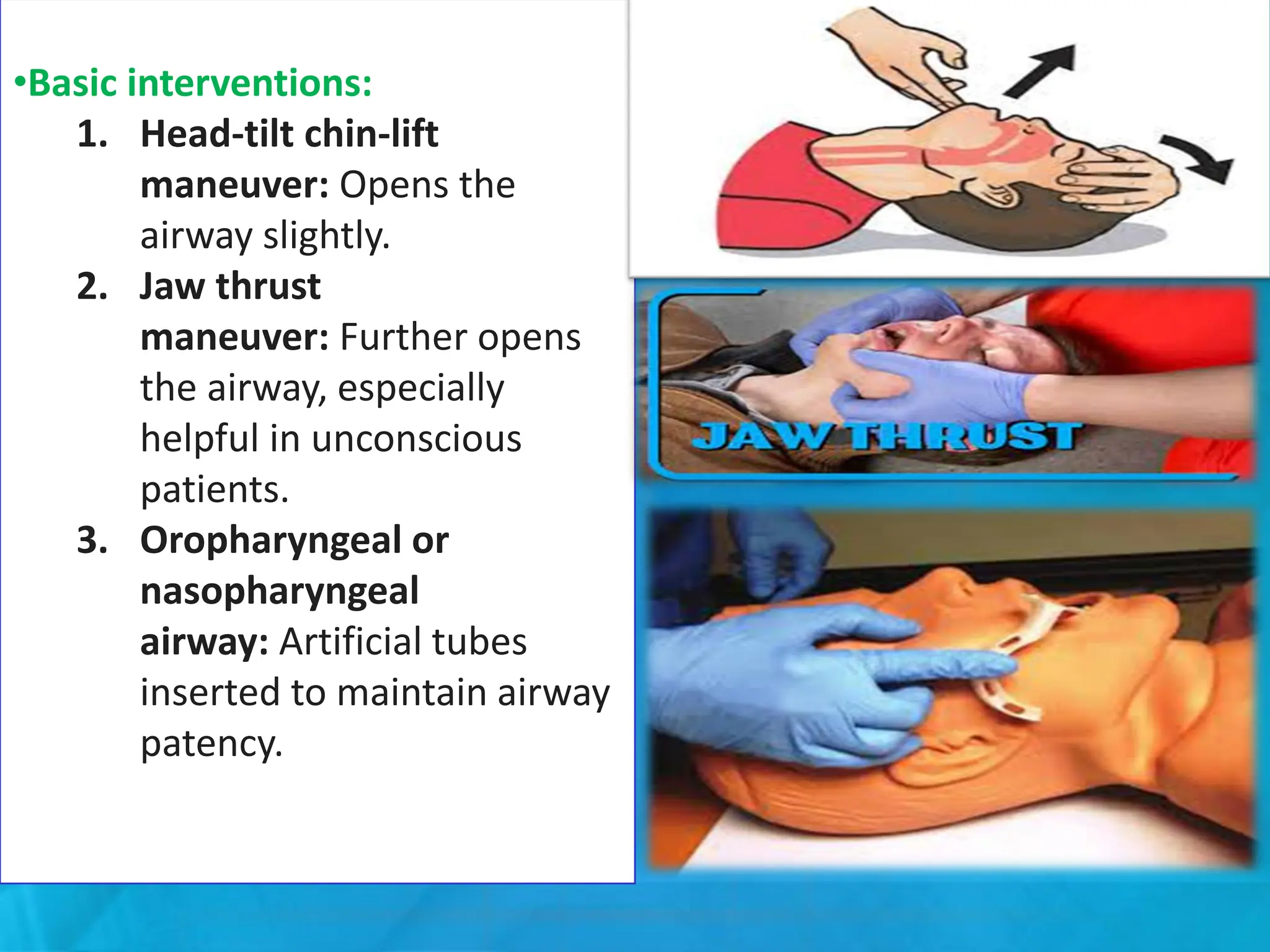 Airway Assessment and Management in emergency medicinent, .pdf
