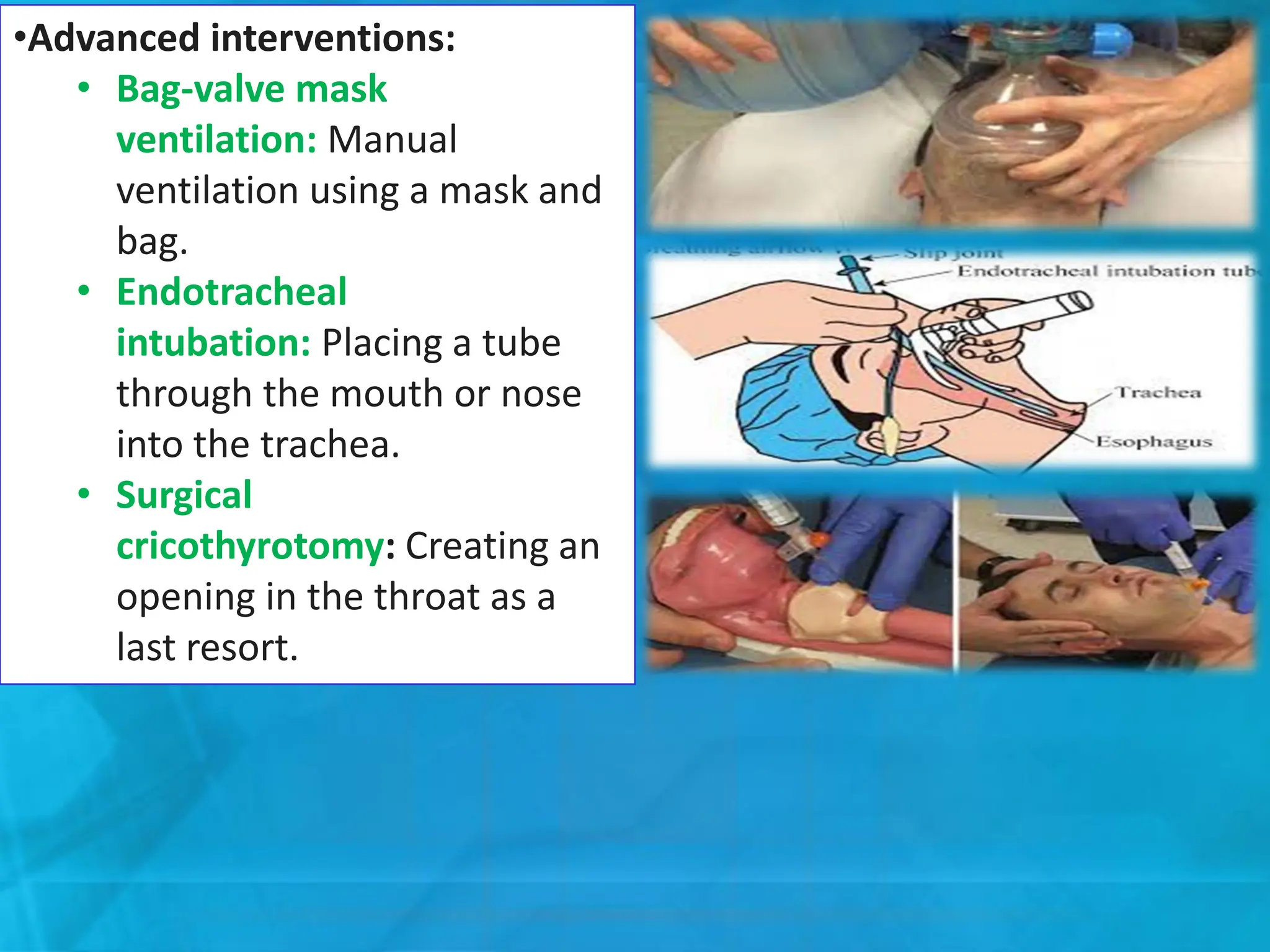 Airway Assessment and Management in emergency medicinent, .pdf