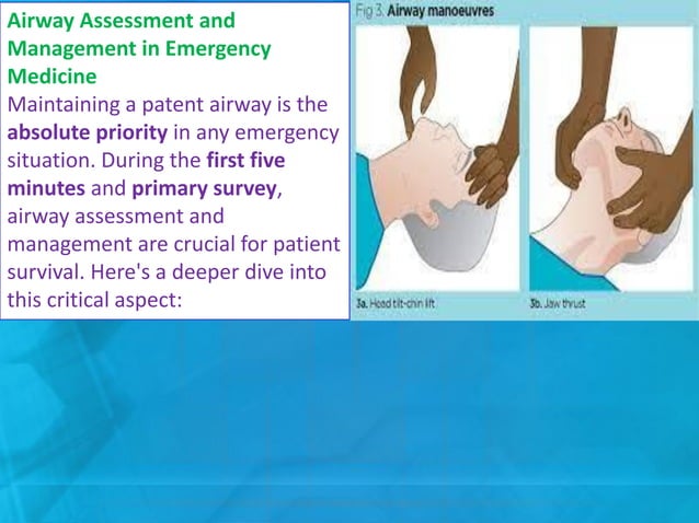 Airway Assessment and Management in emergency medicinent, .pdf
