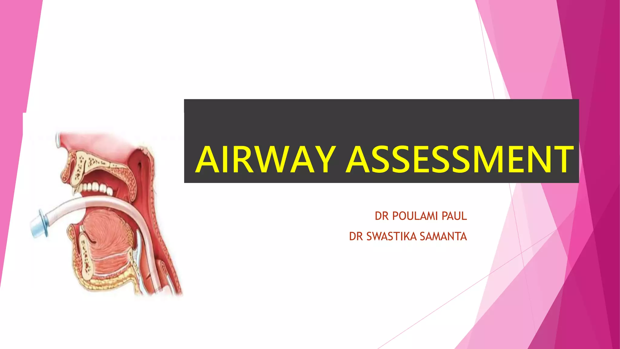 AIRWAY ASSESSMENT FINAL.pptx