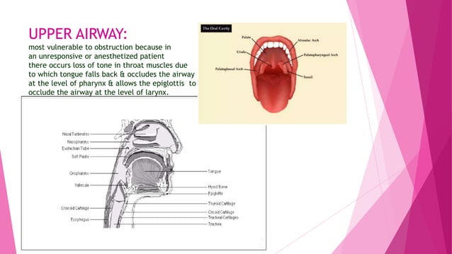 AIRWAY ASSESSMENT FINAL.pptx