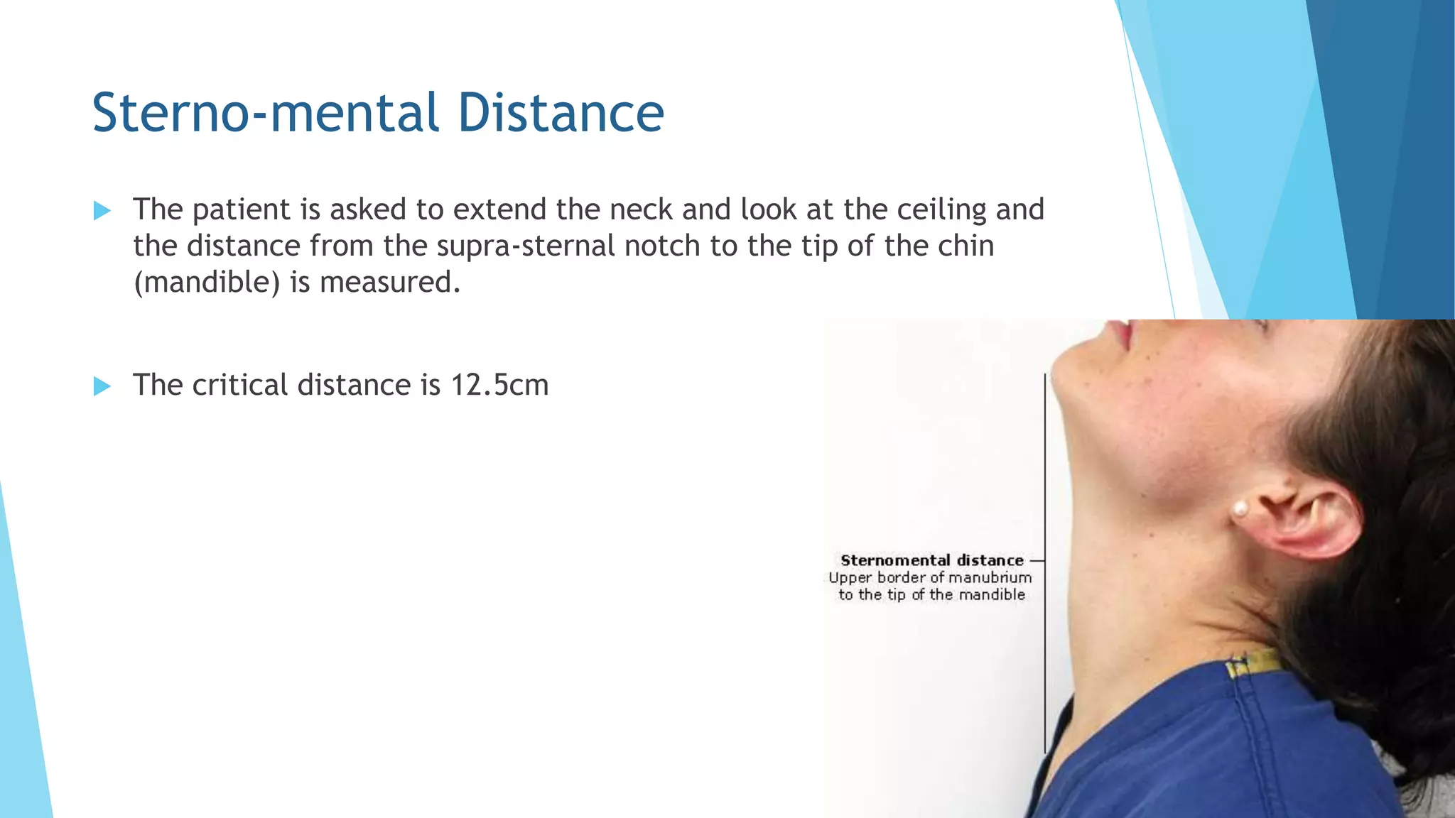 Airway assessment in anaesthesia | PPTX