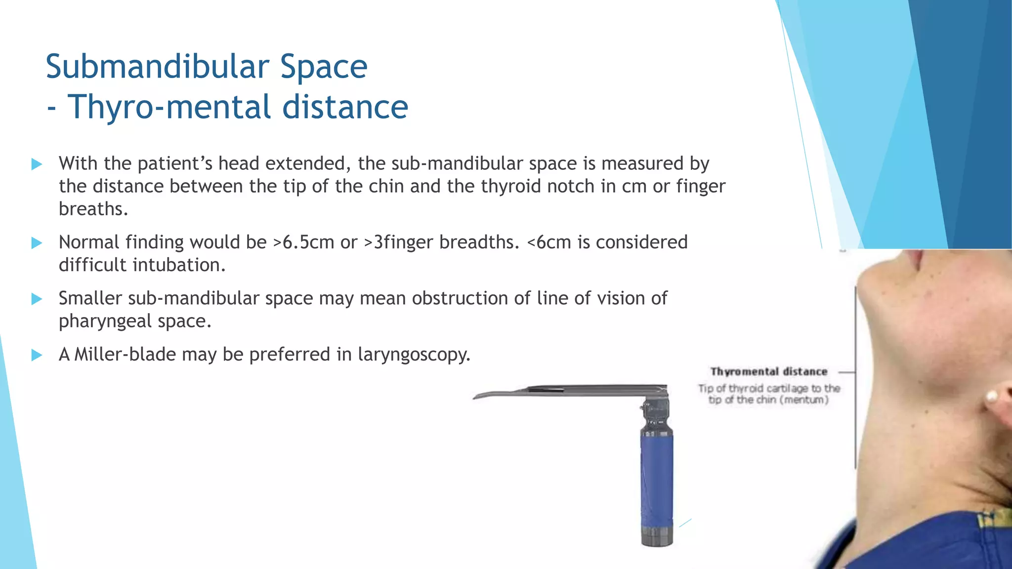 Airway assessment in anaesthesia | PPTX