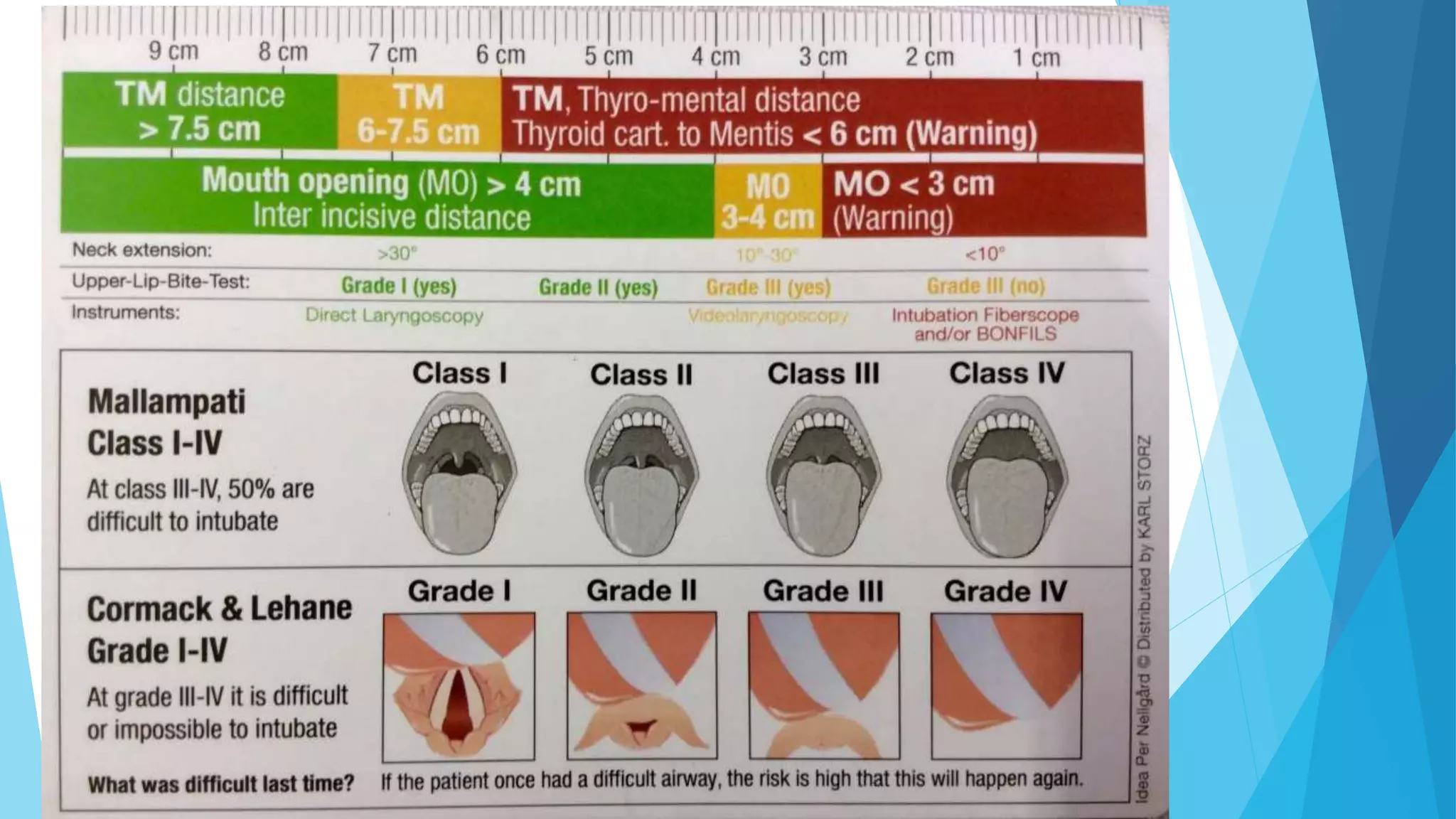 Airway assessment in anaesthesia | PPTX