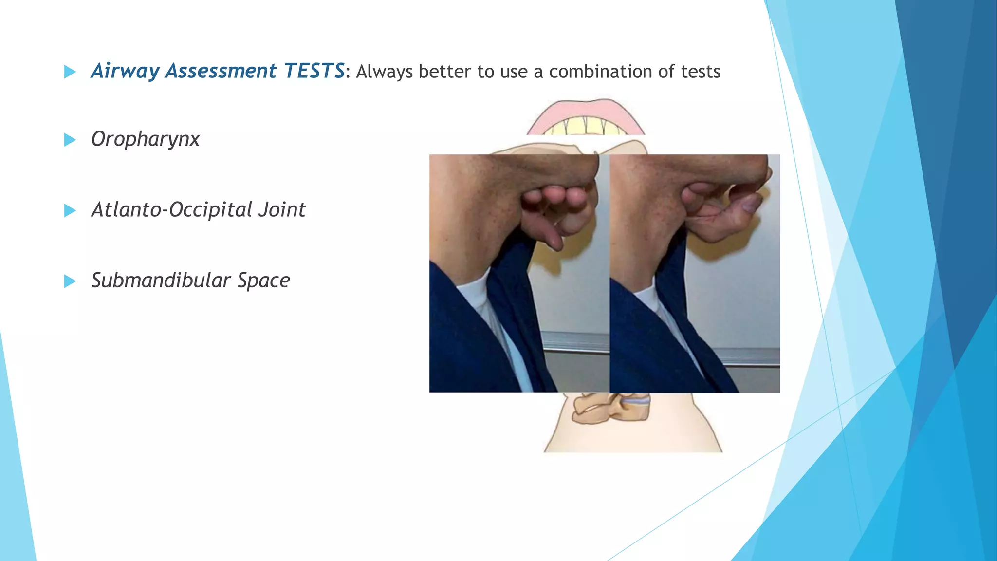 Airway assessment in anaesthesia | PPTX