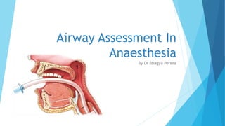 Airway assessment in anaesthesia | PPTX