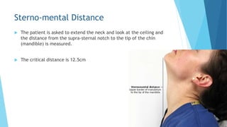 Airway assessment in anaesthesia | PPTX