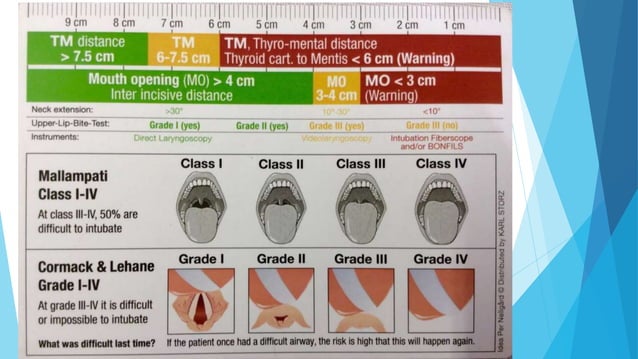 Airway assessment in anaesthesia