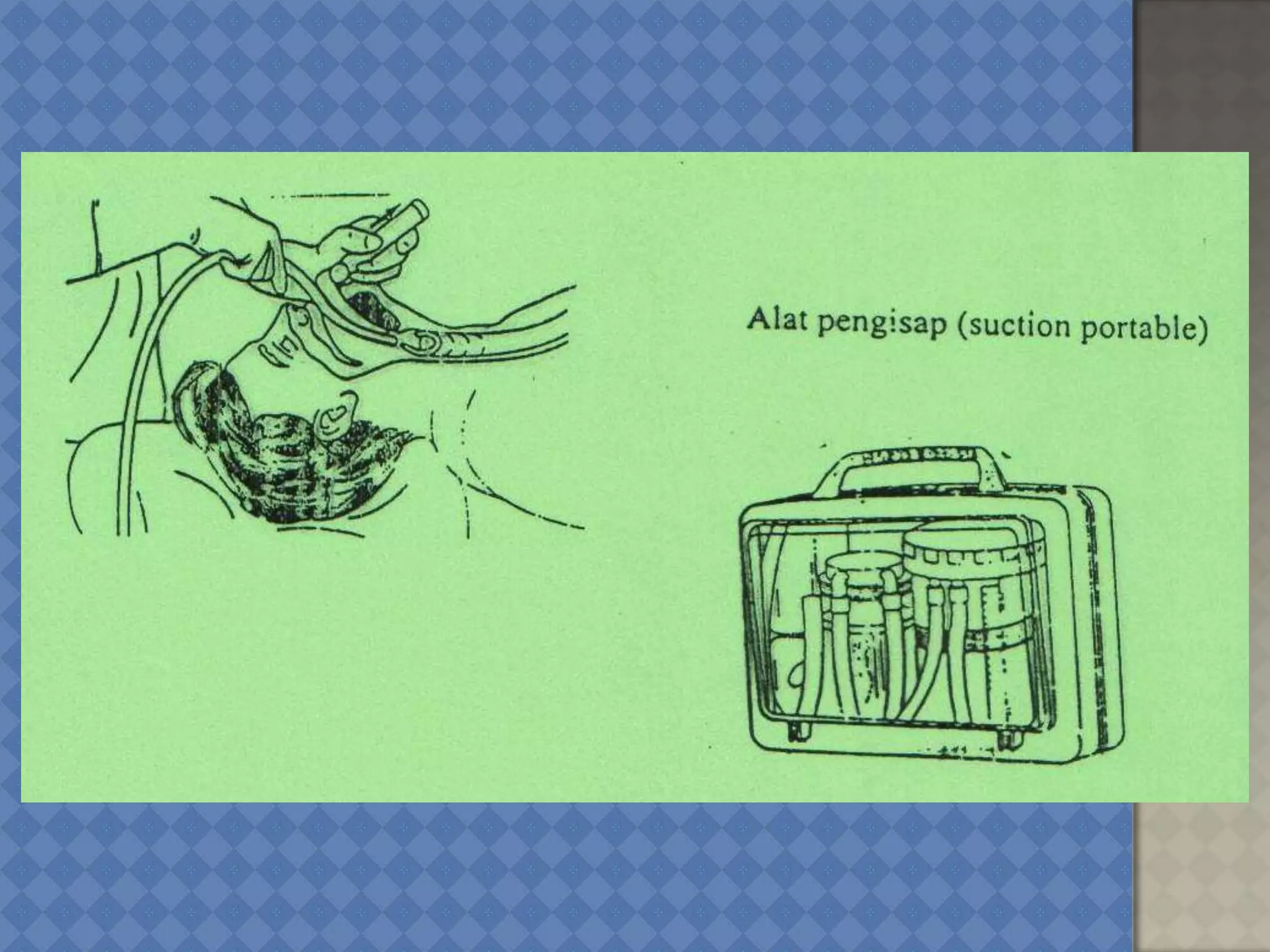 Airway, Breathing dan Circulation (ABC) | PPTX
