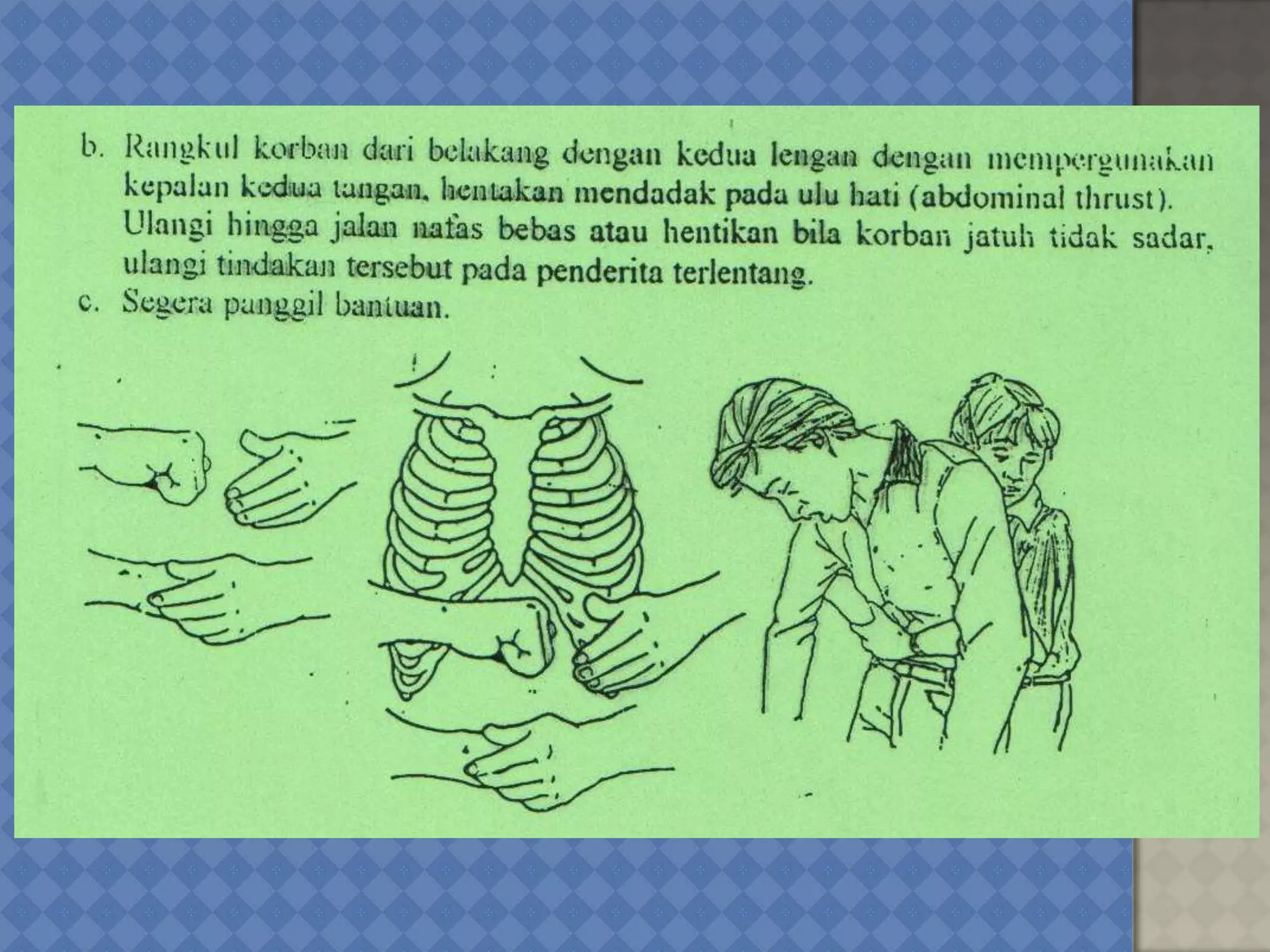 Airway, Breathing dan Circulation (ABC) | PPTX
