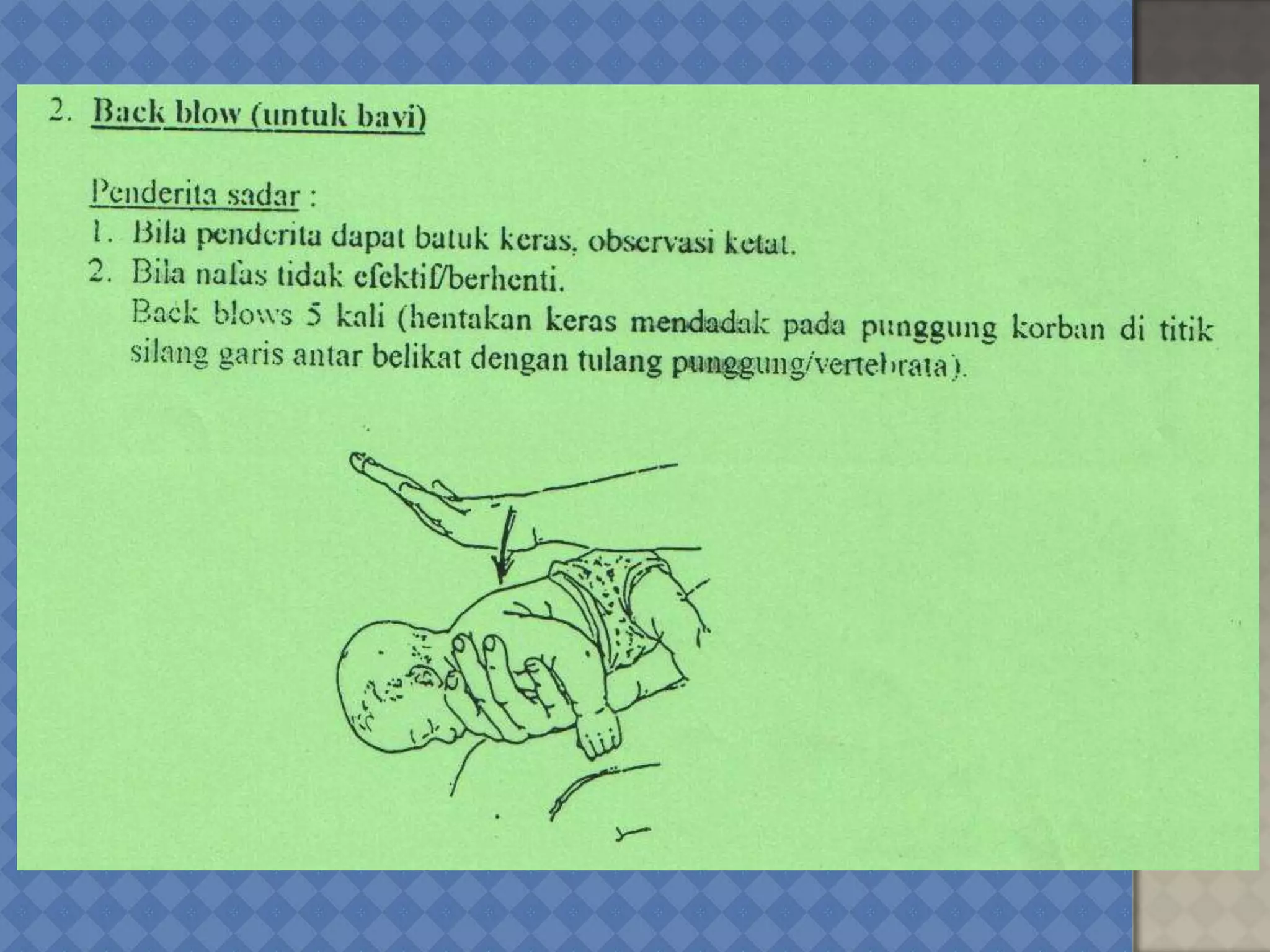 Airway, Breathing dan Circulation (ABC) | PPTX