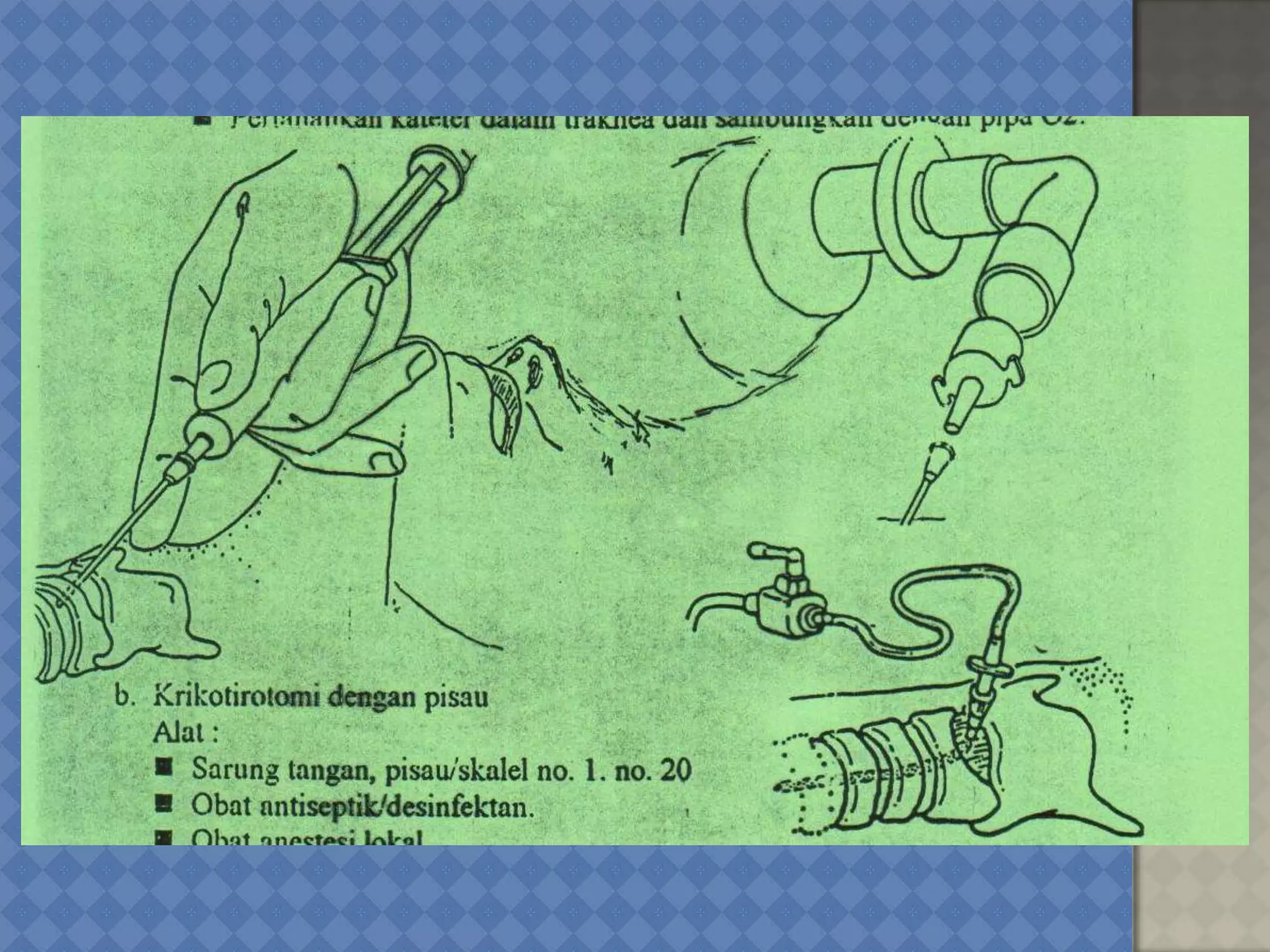 Airway, Breathing dan Circulation (ABC) | PPTX