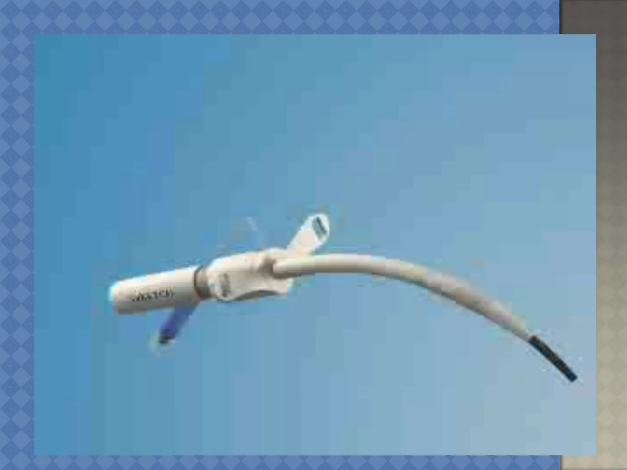 Airway, Breathing dan Circulation (ABC) | PPTX