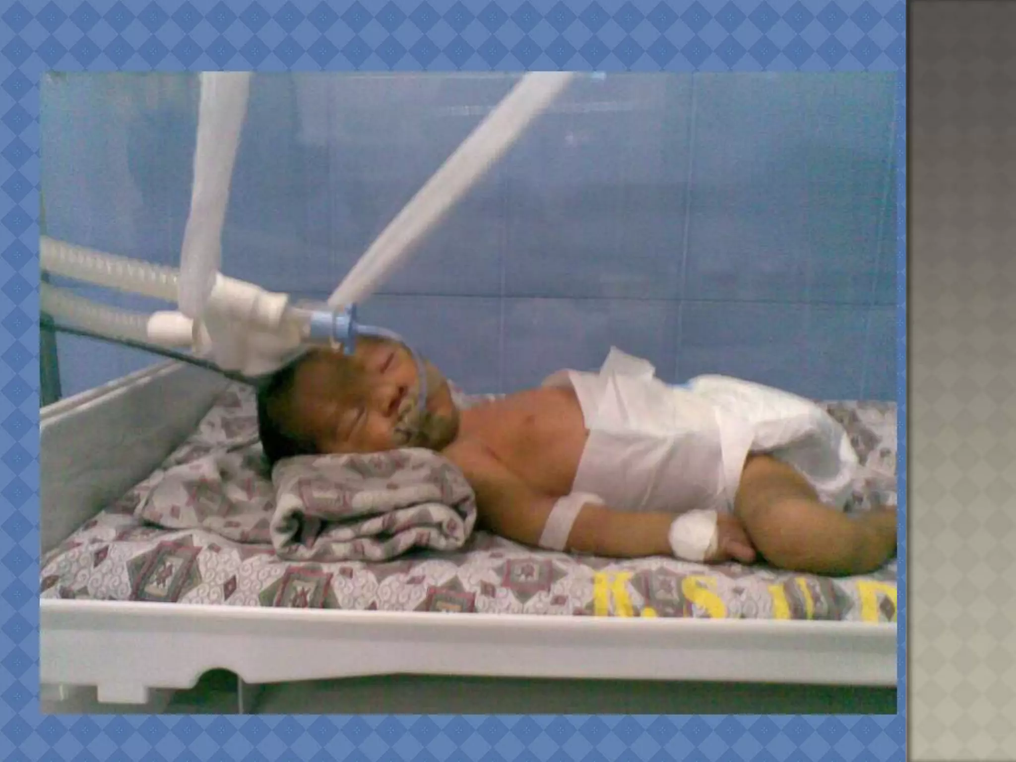 Airway, Breathing dan Circulation (ABC) | PPTX