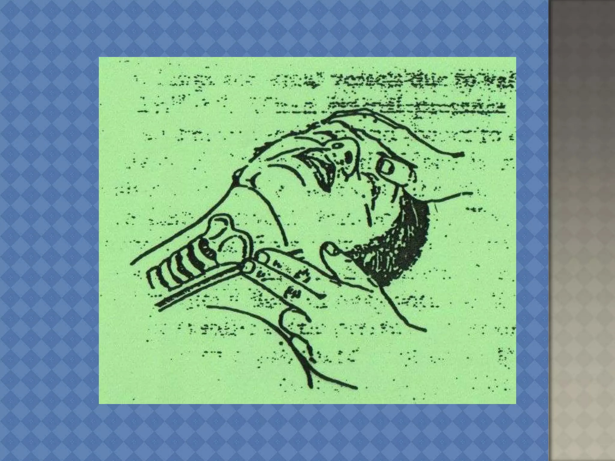 Airway, Breathing dan Circulation (ABC) | PPTX