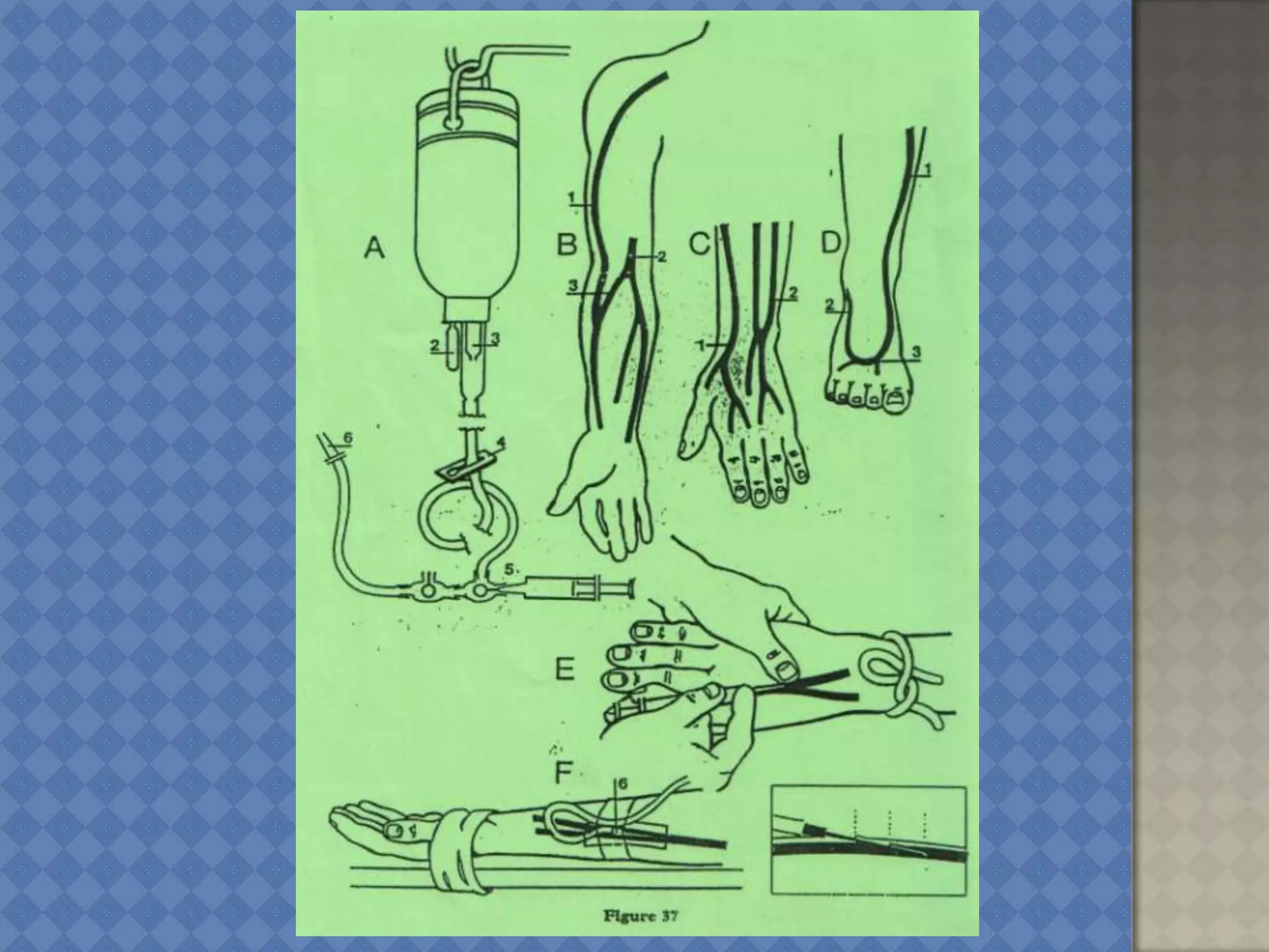Airway, Breathing dan Circulation (ABC) | PPTX