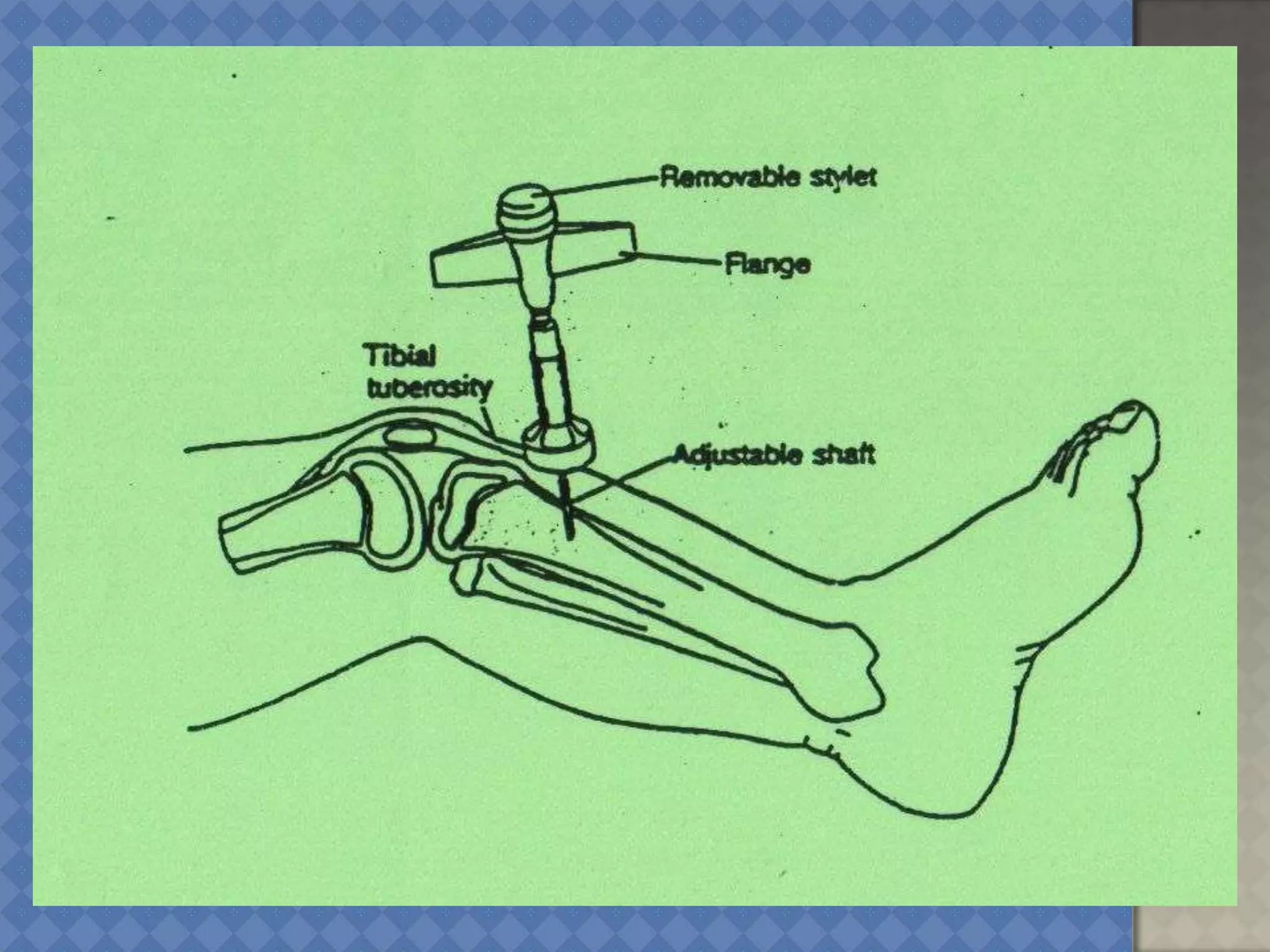 Airway, Breathing dan Circulation (ABC) | PPTX
