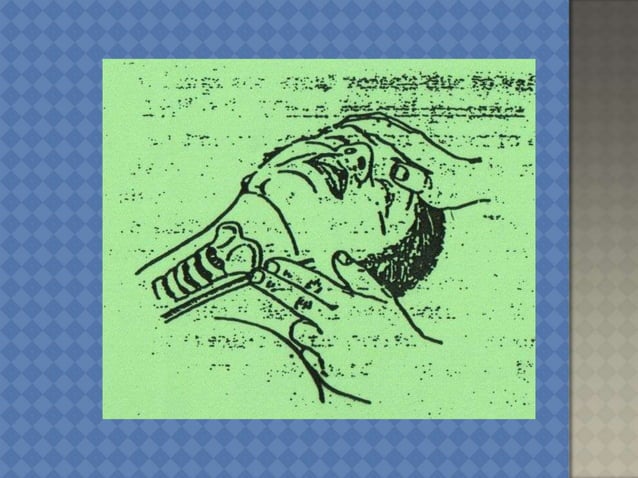 Airway, Breathing dan Circulation (ABC) | PPTX