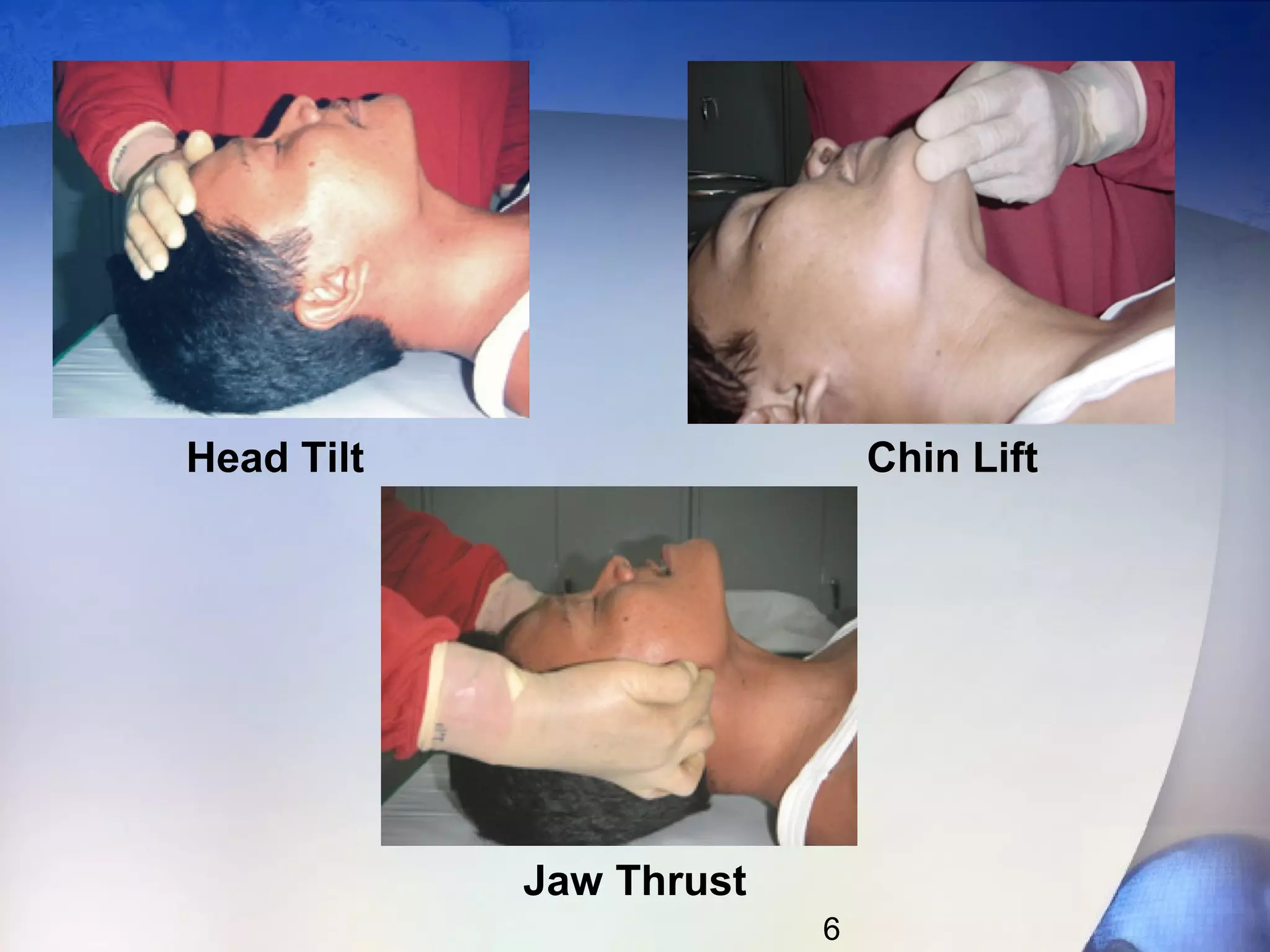Airway breathingmanagement | PPT