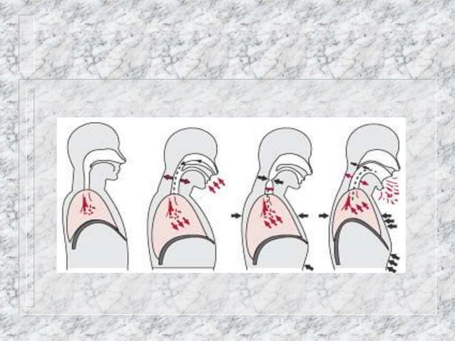 Airway clearence technique | PDF