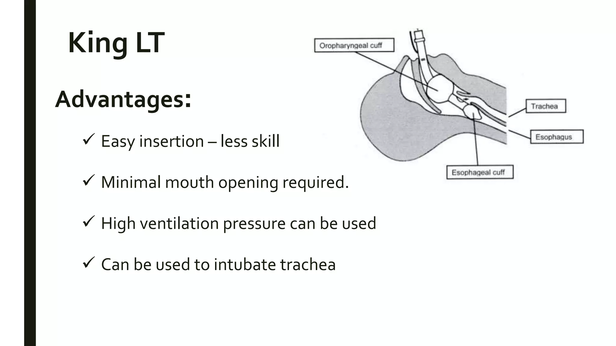 Airway devices and adjuncts | PPTX