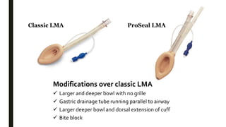 Airway devices and adjuncts | PPTX