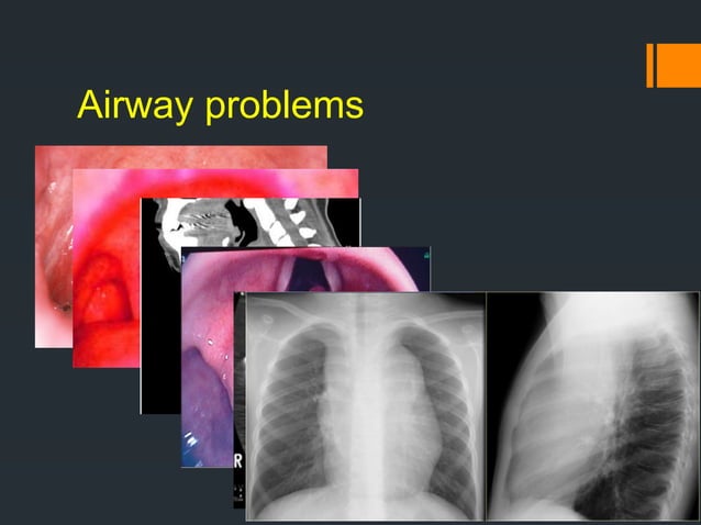 Airway emergencies and anaesthetics.pptx