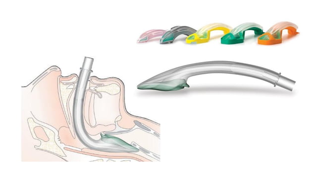 Airway equipments for Anaesthesia | PDF