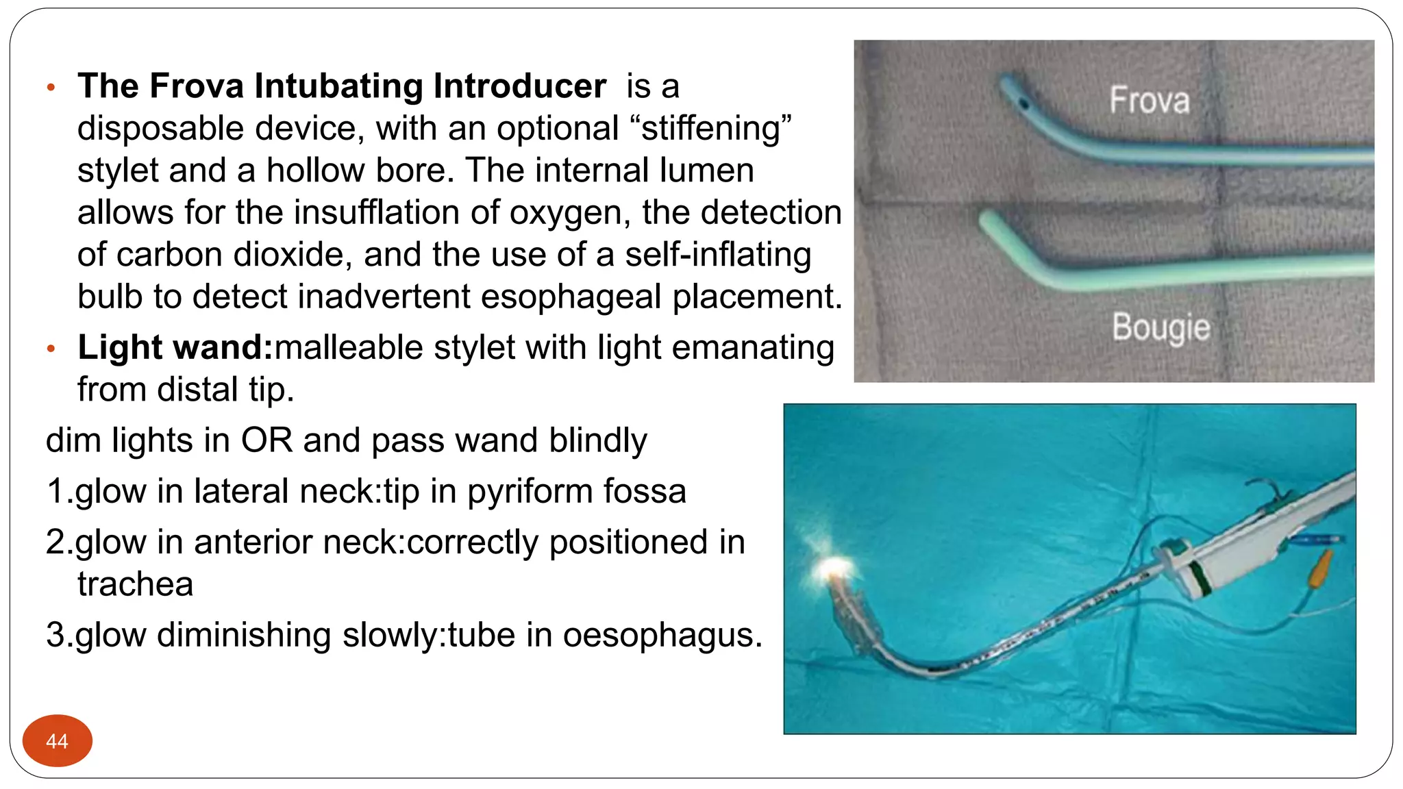 Airway equipment | PPTX