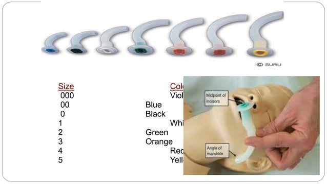 Airway equipment | PPTX | Ear, Nose and Throat Conditions | Diseases ...