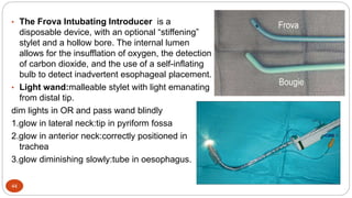 Airway equipment | PPTX