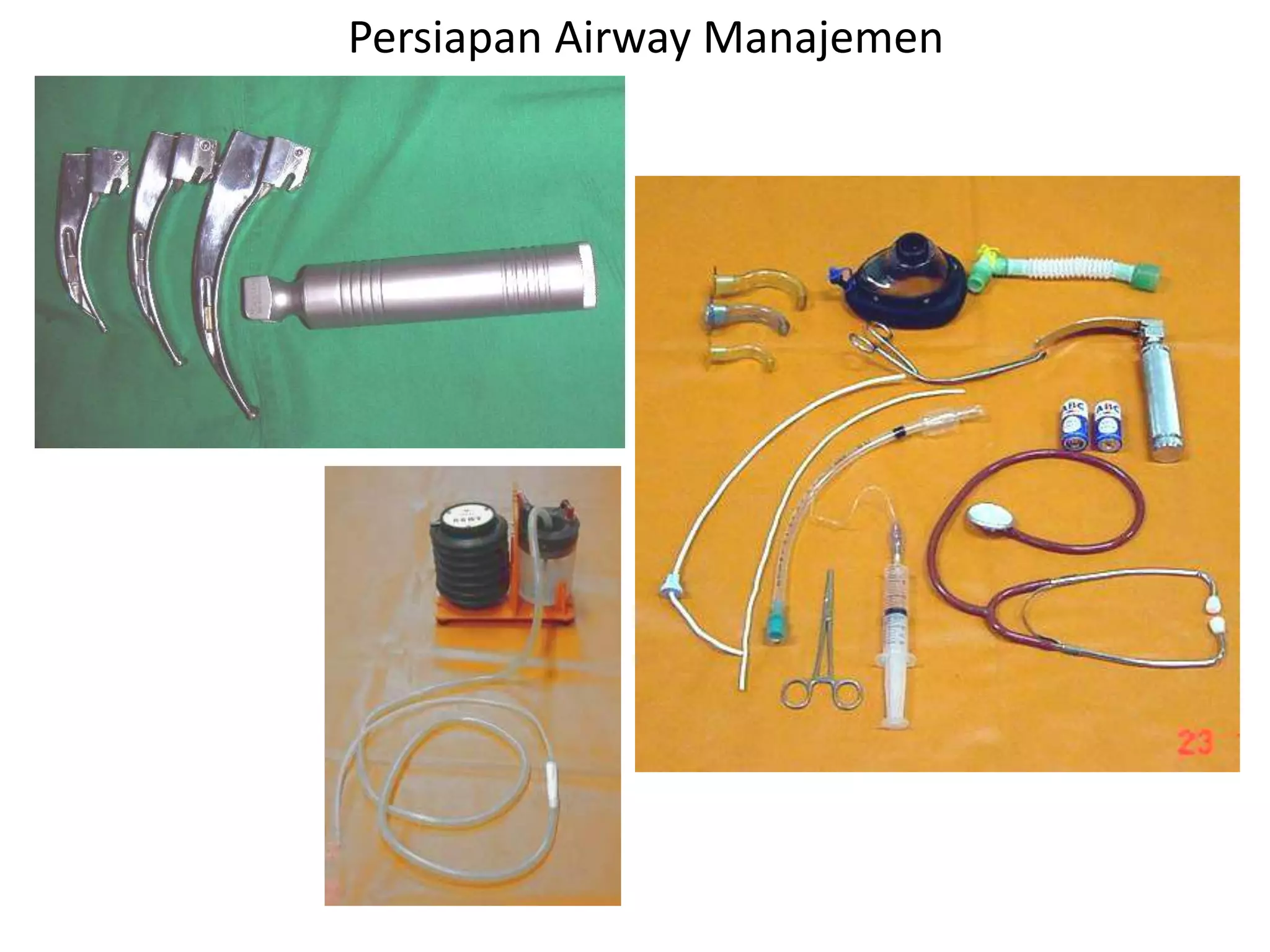 AIRWAY FIX.pptx