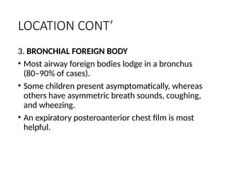 AIRWAY FOREIGN BODIES.pptx peadiatrics rotation | PPT