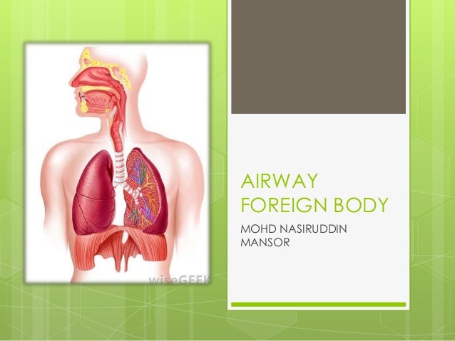 Airway foreign body