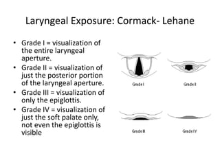 Airway inubation difficulties | PPTX