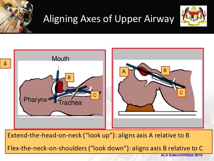 Airway lecture06122011