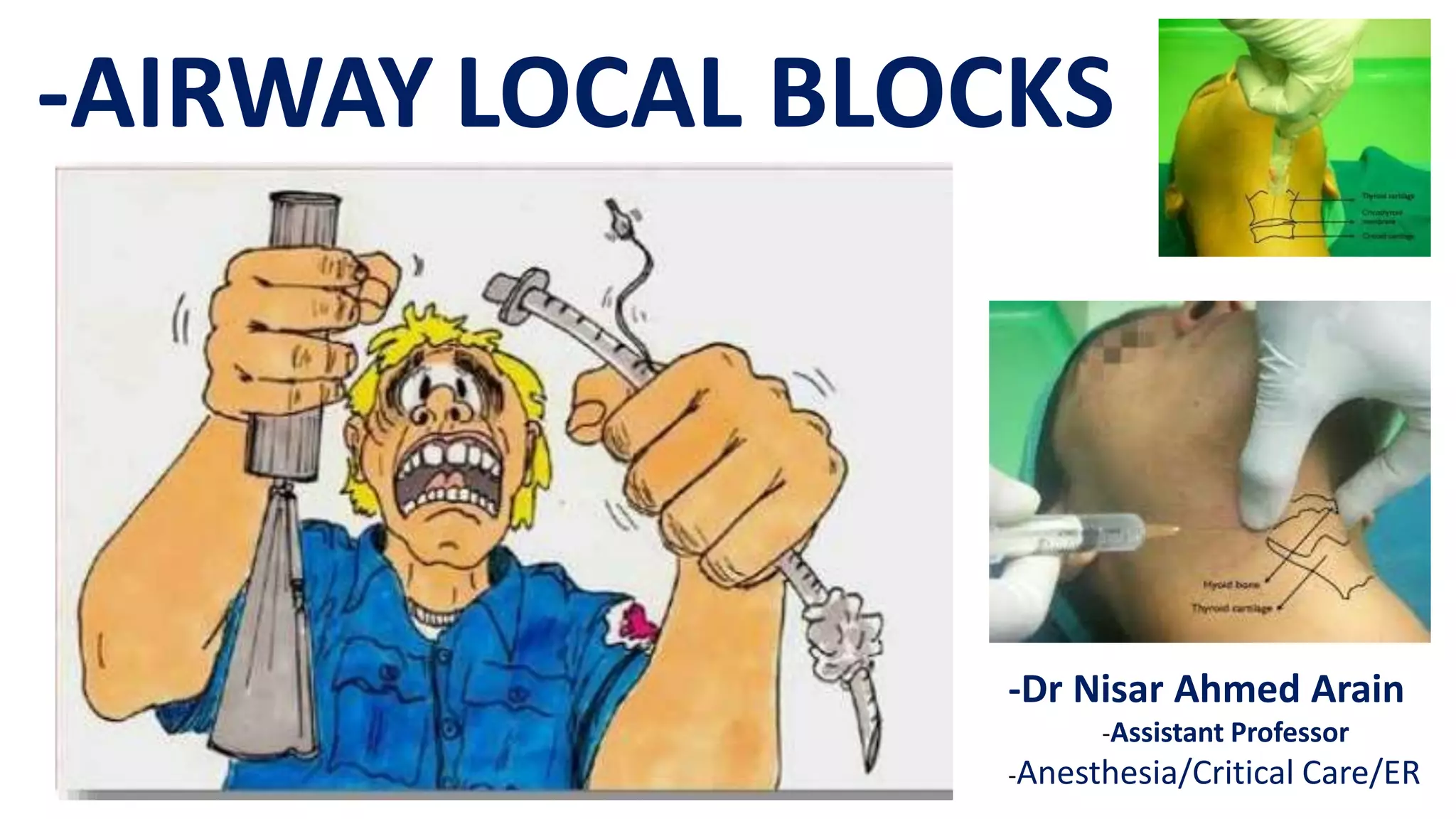 Airway local blocks | PPTX