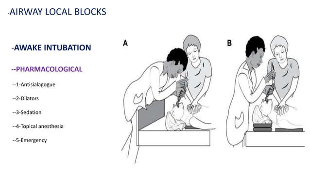 Airway local blocks | PPTX | Ear, Nose and Throat Conditions | Diseases ...