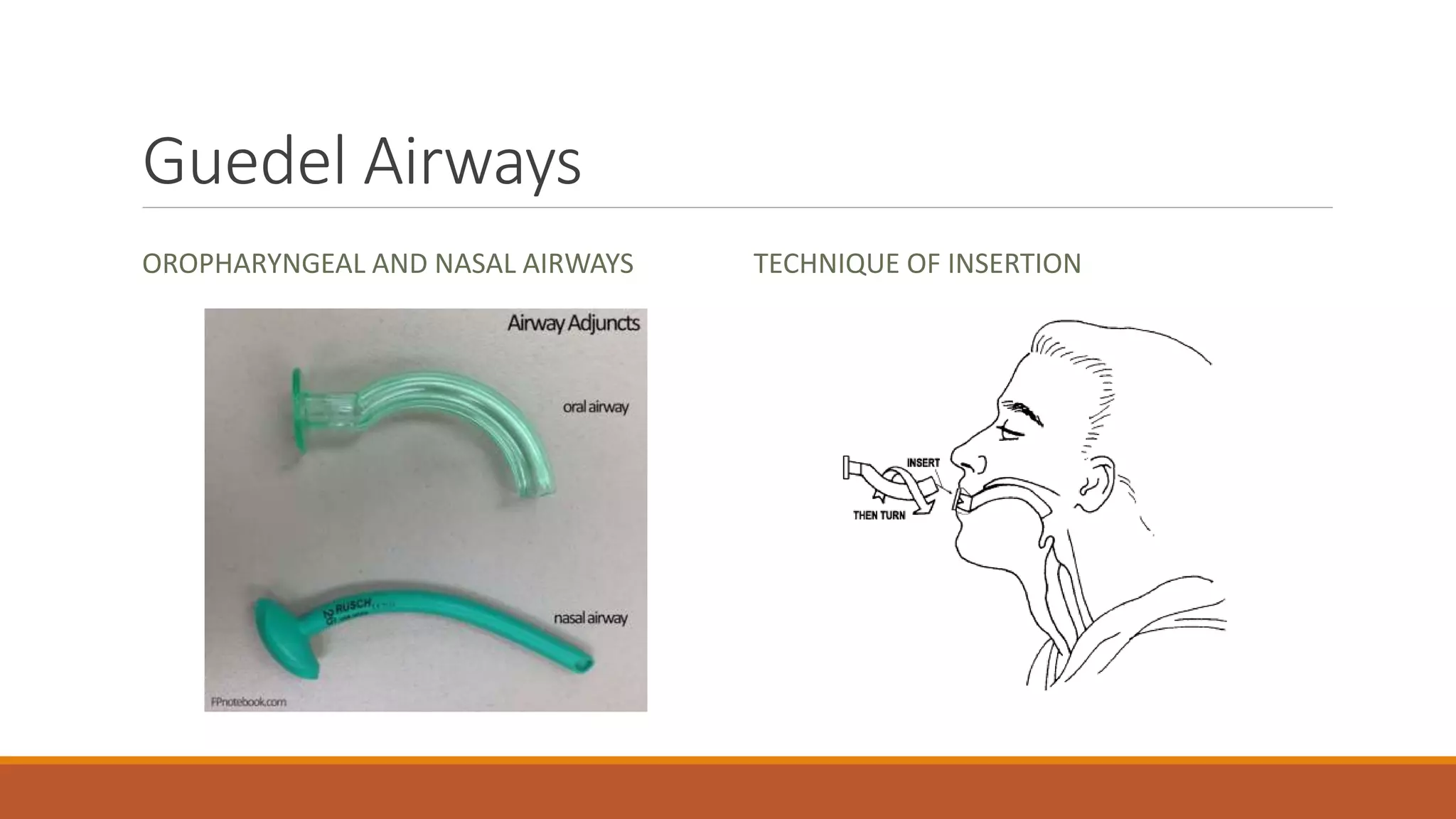 Airway manaement.pptx