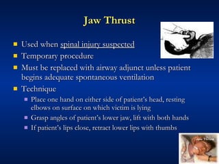 Airway management | PPT