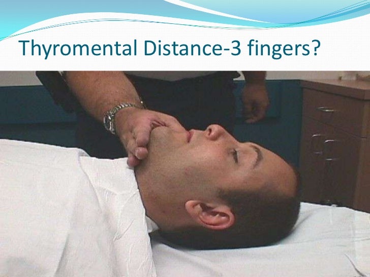 Airway management in for seadtion