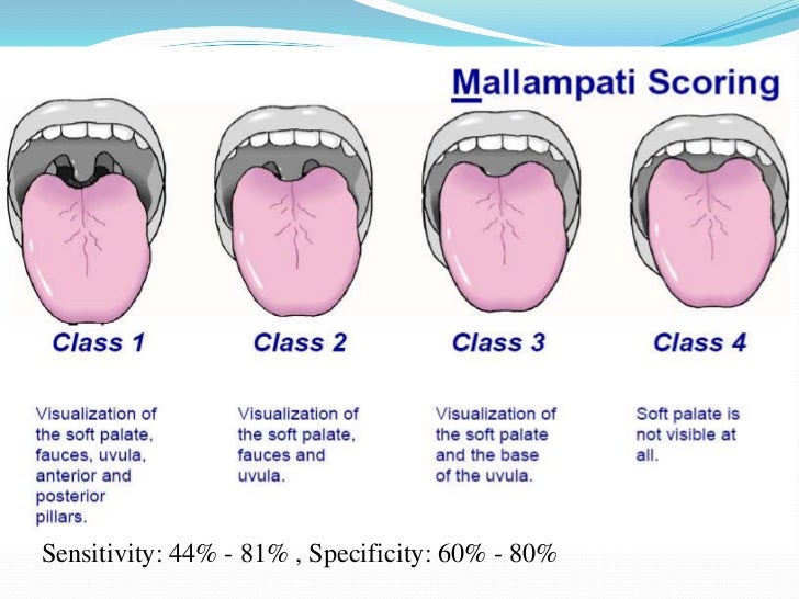 Airway management in for seadtion