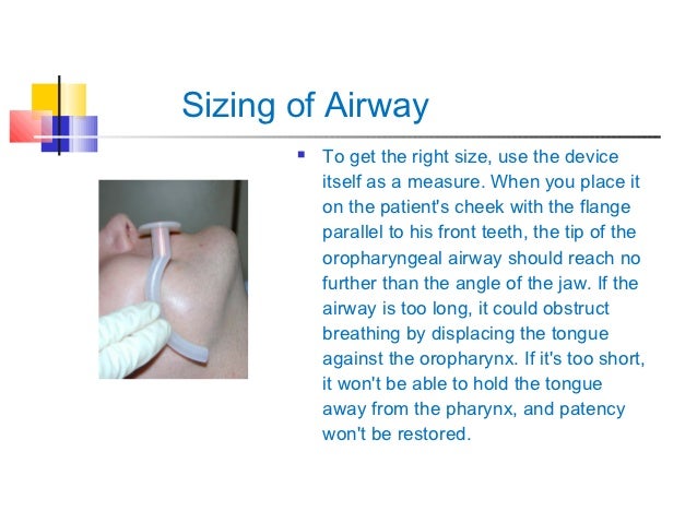 Airway management