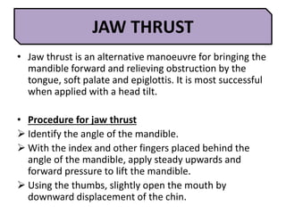 Airway management | PPTX | Death, Injury, or Military Conflict ...