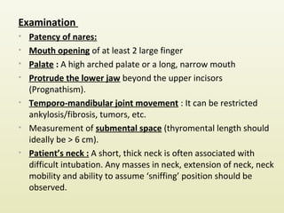 Airway management | PPT